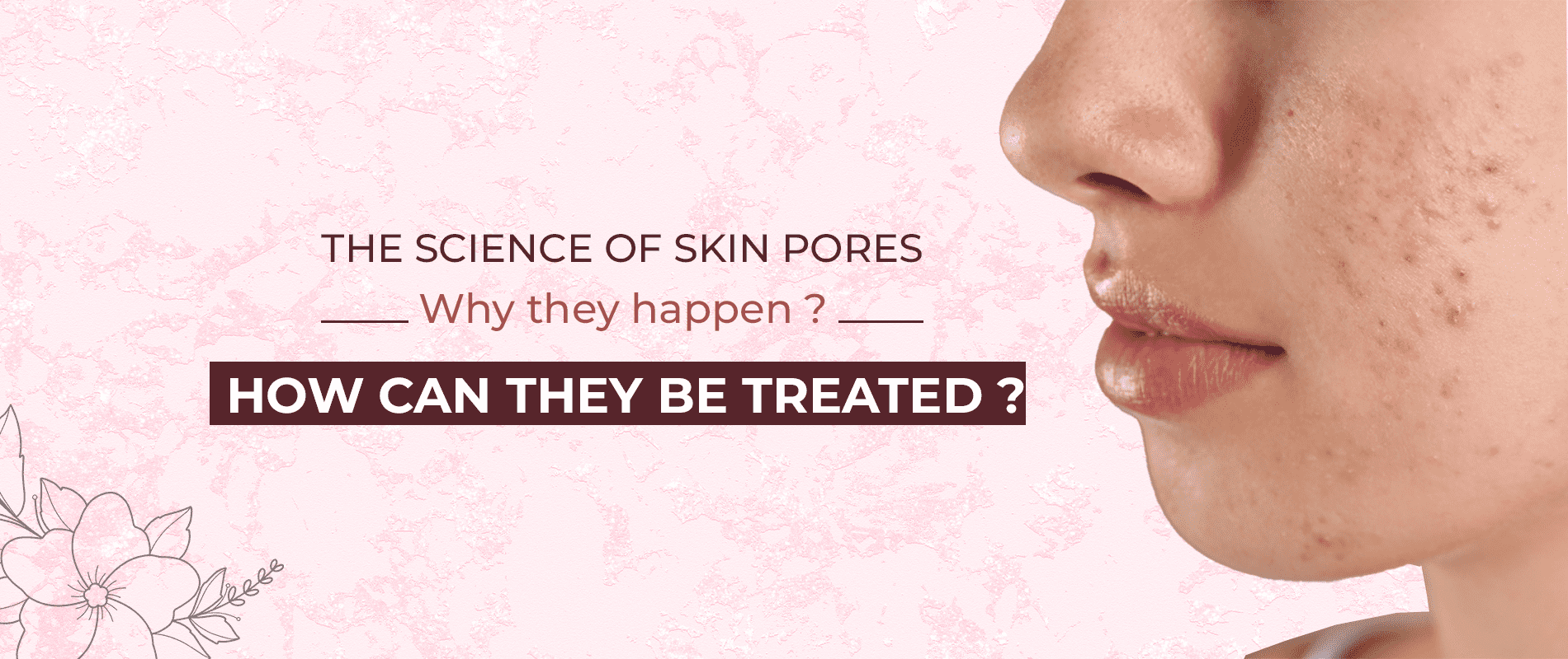 The Science of Skin Pores: Why they happen & how can they be treated? – Anherb Natural